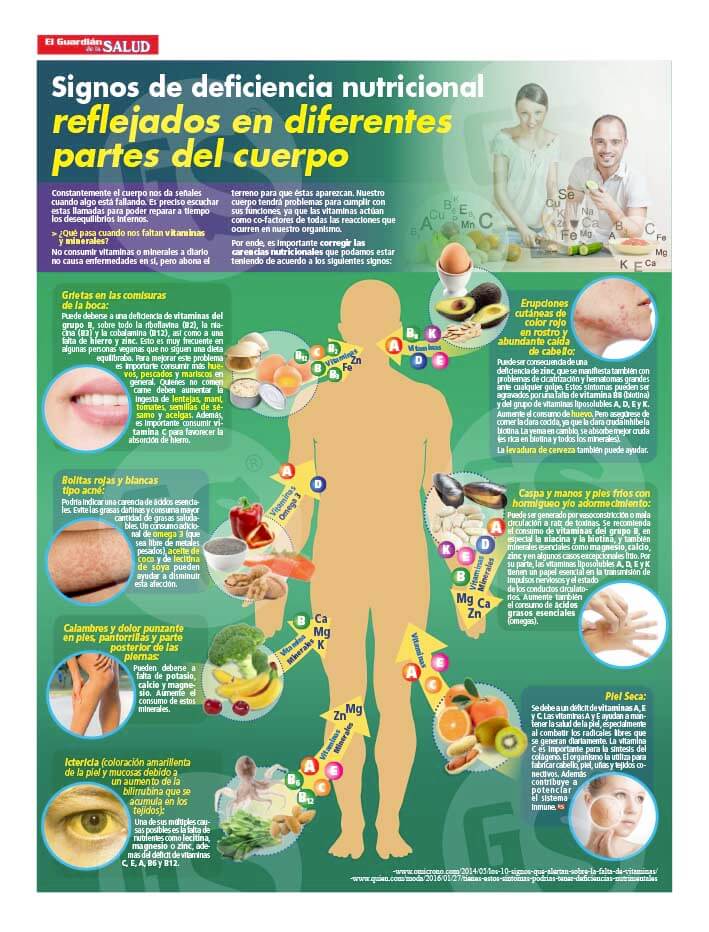 Infografía Deficiencia nutricional - El Guardián de la Salud